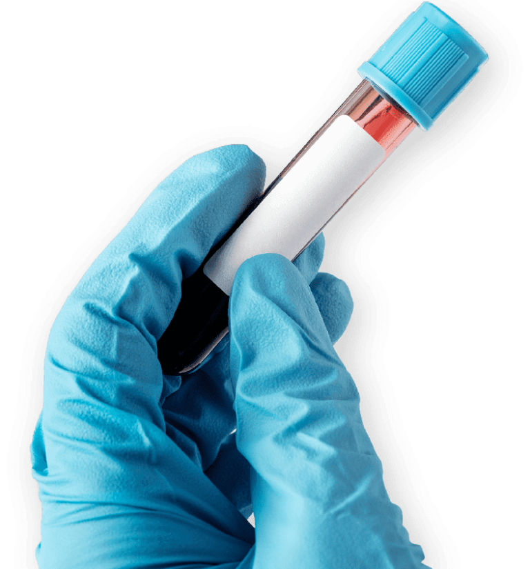Laboratory Tests in Malaysia - Lablink Medical Laboratory