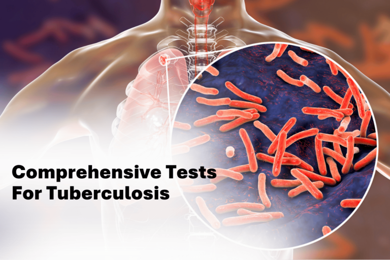 Understanding Tuberculosis: Symptoms and Laboratory Tests Offered ...